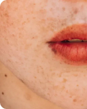 Skin Conditions We Treat – Dermatica